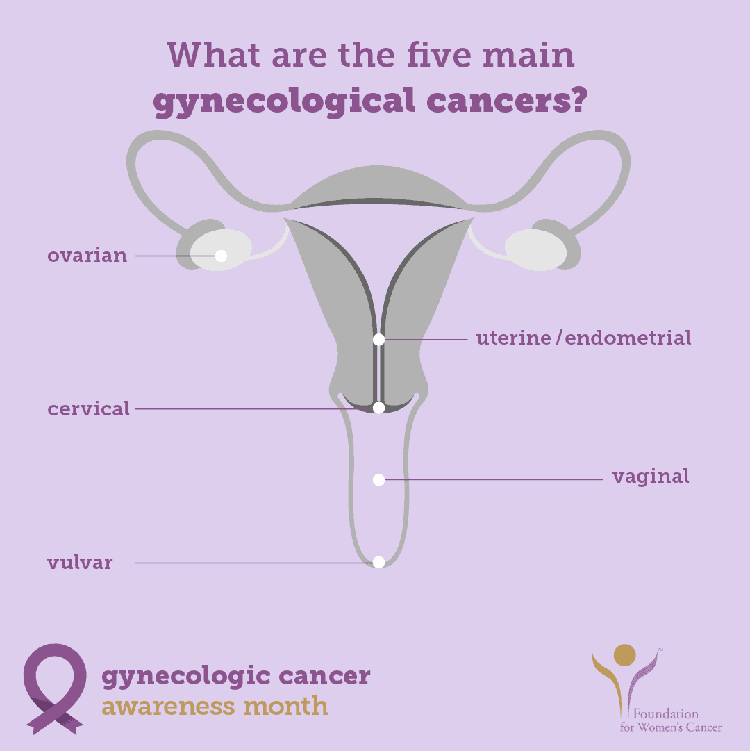 Spotlight on Vaginal Cancer – Newcastle Gynaecology Clinic